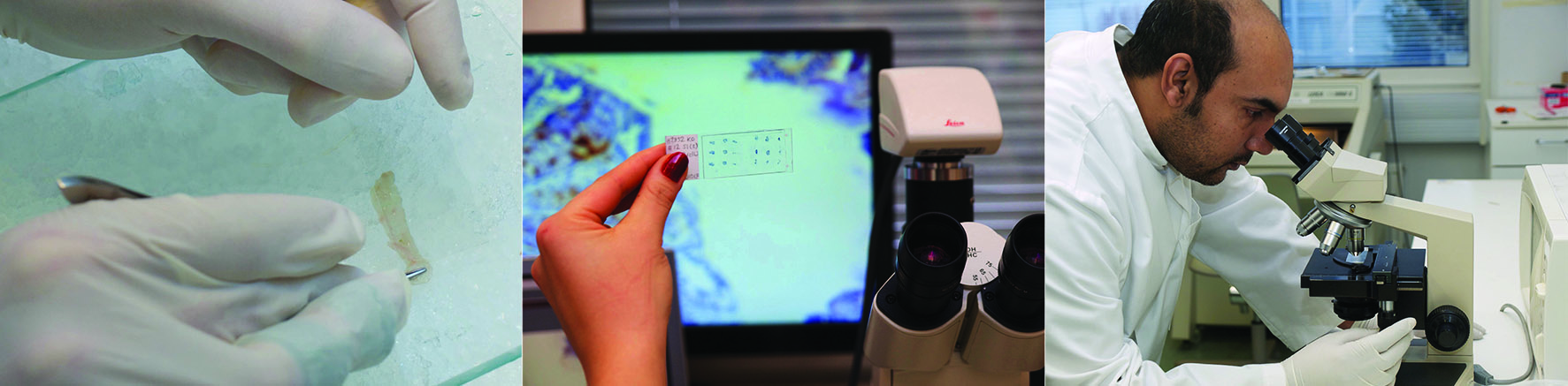 Intestinal Analysis Methods | TCDM - Turku Center for Disease Modeling Intestinal Analysis Methods | TCDM - Turku Center for Disease Modeling